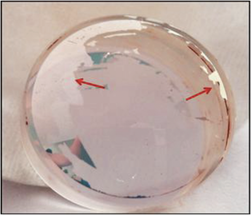 Illustrations of Visible Defects in Optical Elements - SZLASER