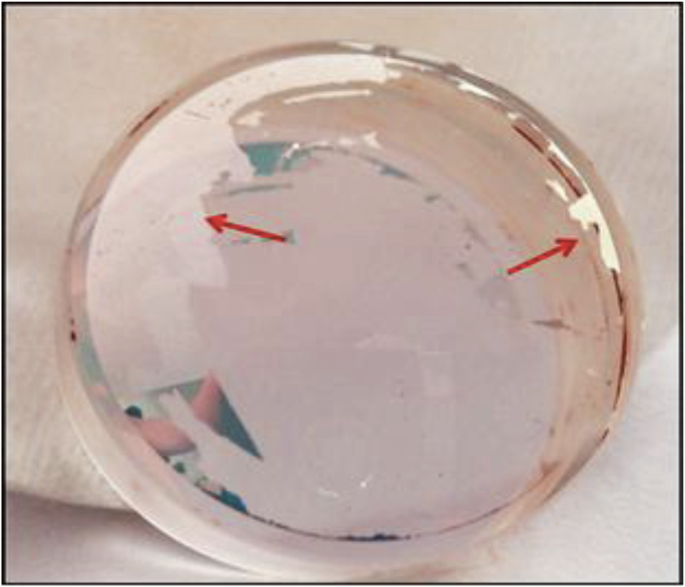 Illustrations of Visible Defects in Optical Elements - SZLASER